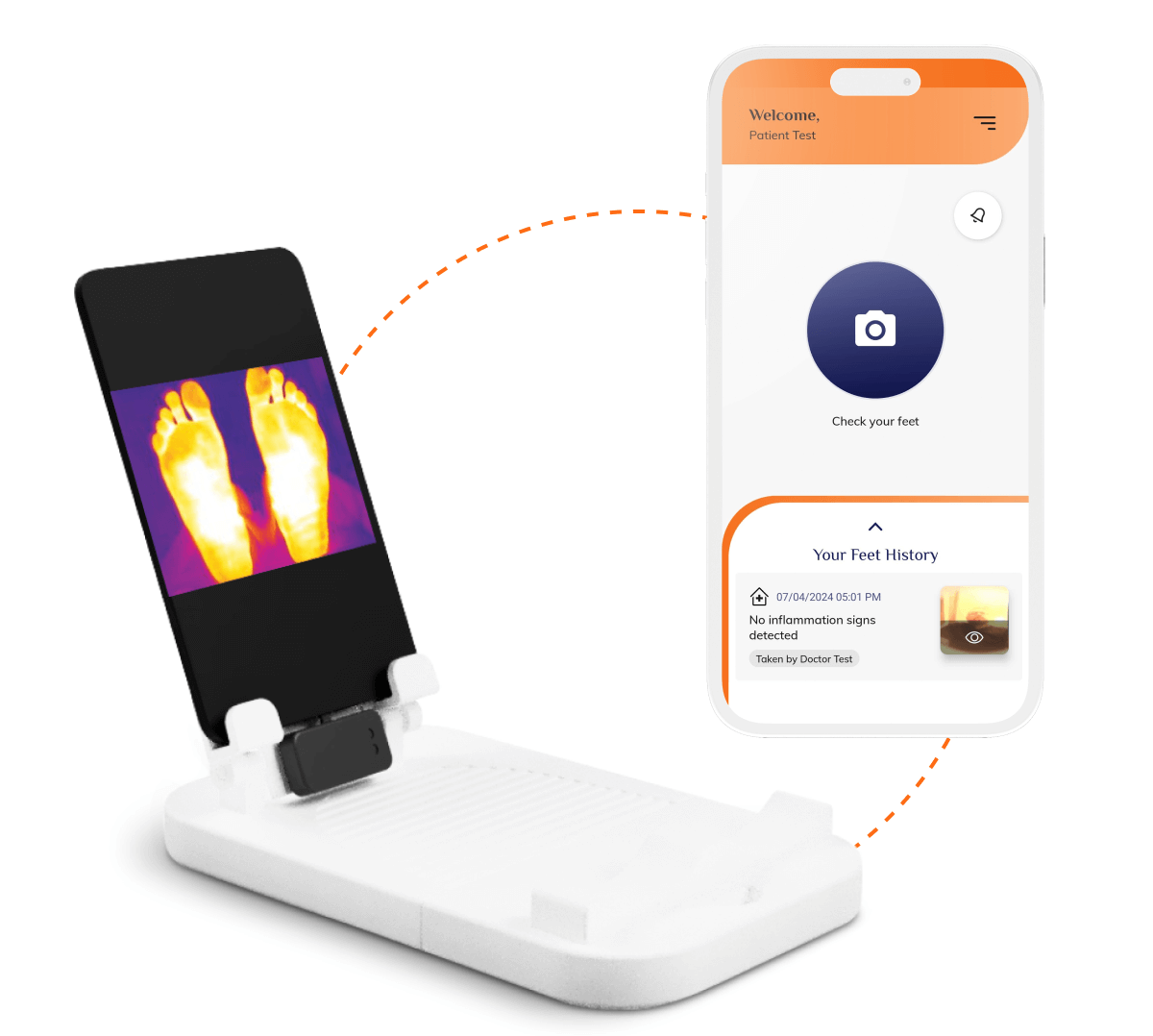 Diabetic Foot Monitoring - Feetsee